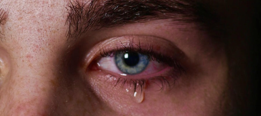 What Causes Watery Eyes and How Can You Treat Them? – SightSage